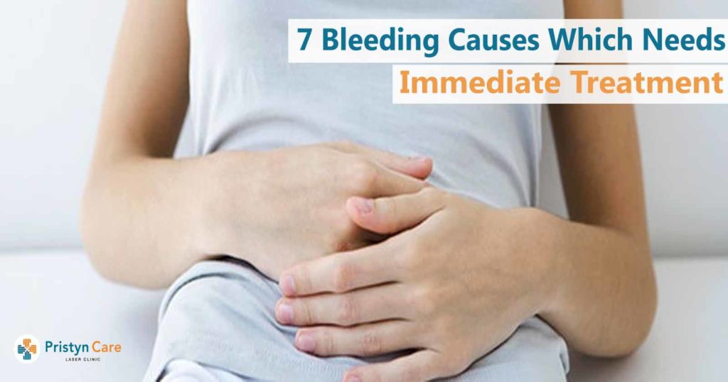 Why do I have a 10 day period with light bleeding? - Pristyn Care