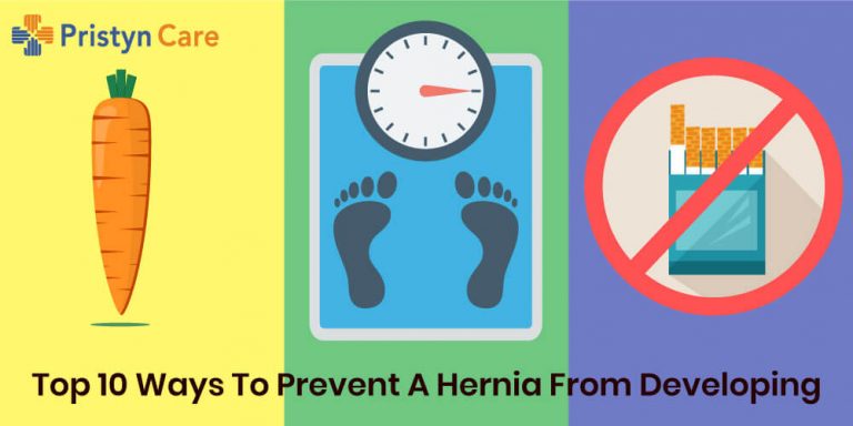 How To Prevent Hernia 10 Ways To Prevent Hernia Problem