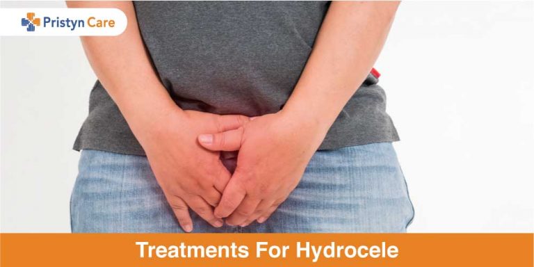 Hydrocele Treatment Without Surgery