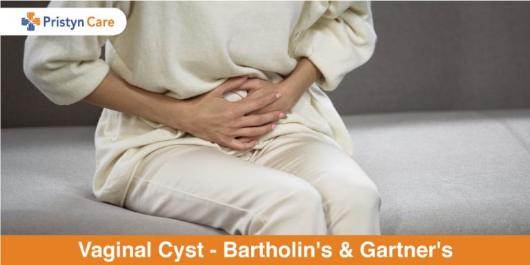 Overview of Bartholin's and Gartner's Vaginal Cysts - Pristyn Care