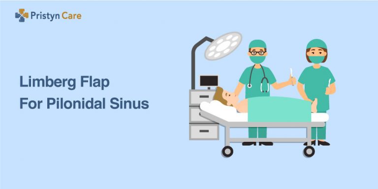 How to stop recurrence of Pilonidal Cyst? - Pristyn Care