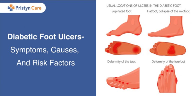Diabetic Foot Ulcer Home Treatment - Pristyn Care