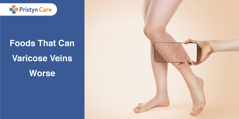 Foods That Can Make Varicose Veins Worse Pristyn Care