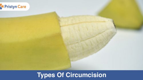 Laser Circumcision For Phimosis