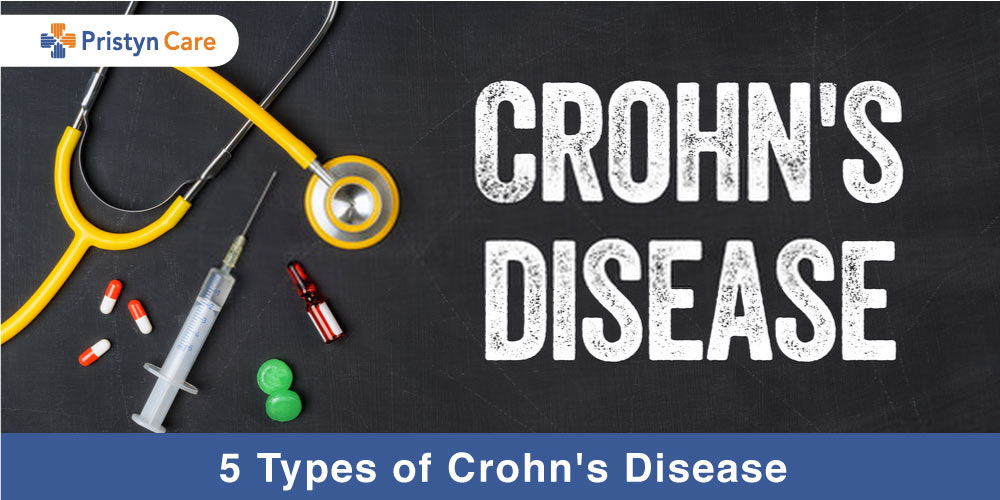 5 Types Of Crohns Disease Pristyn Care