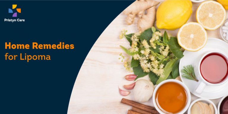 Home Remedies for Lipoma