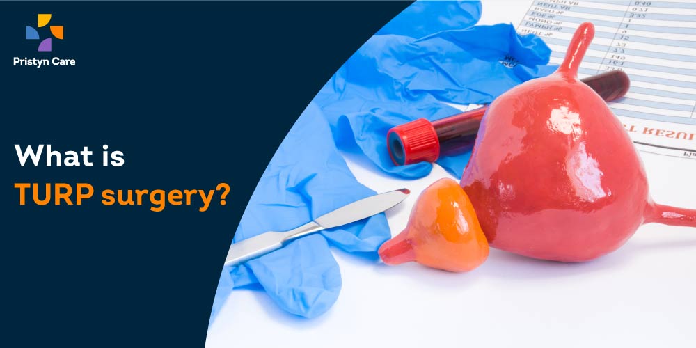 TURP Surgery Procedure Benefits Recovery And Complications