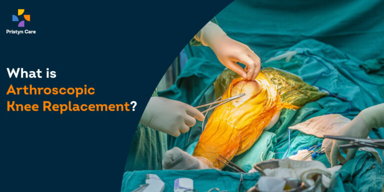 Knee Replacement Archives - Pristyn Care