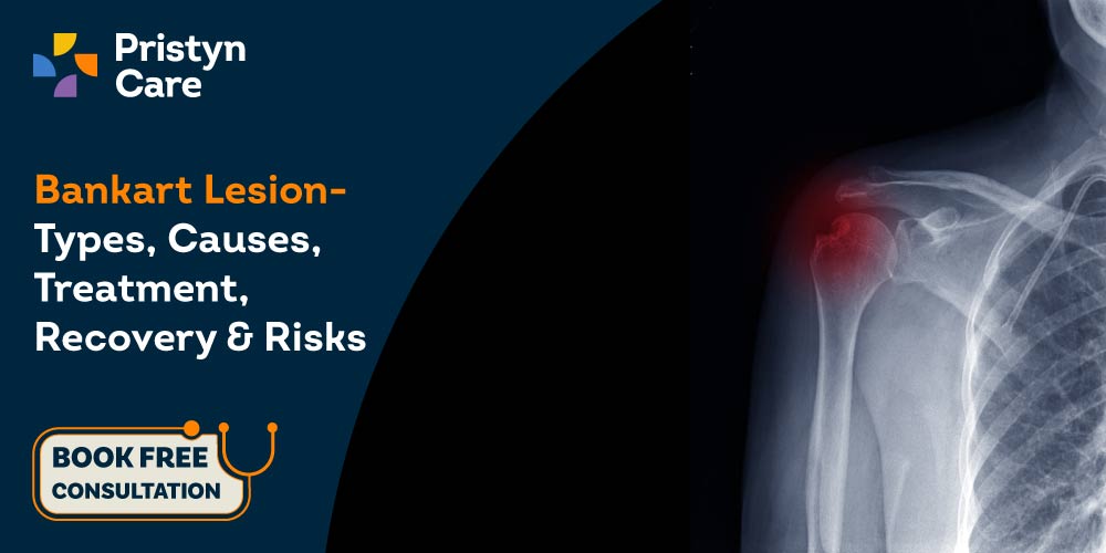 Orthopedic Archives - Page 3 of 8 - Pristyn Care