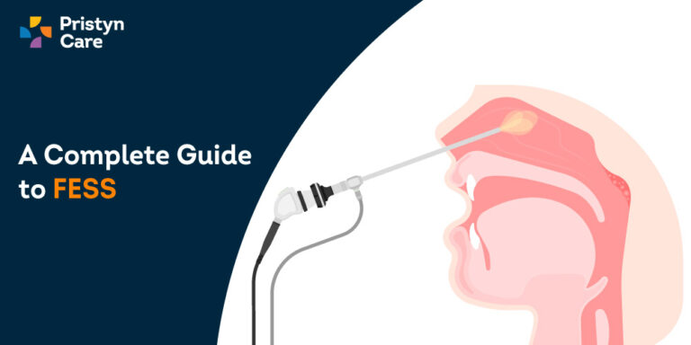 Sinus Archives - Pristyn Care