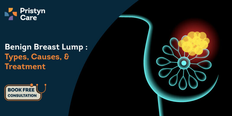 Benign Breast Lump-Causes, Types, & Treatment - Pristyn Care