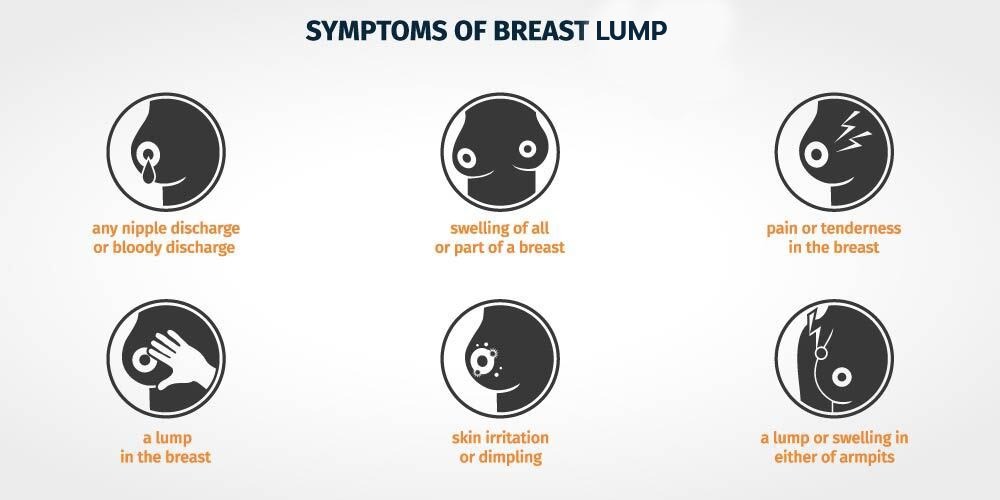 Benign Breast Lump-Causes, Types, & Treatment - Pristyn Care