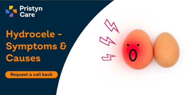 Hydrocele Treatment Without Surgery