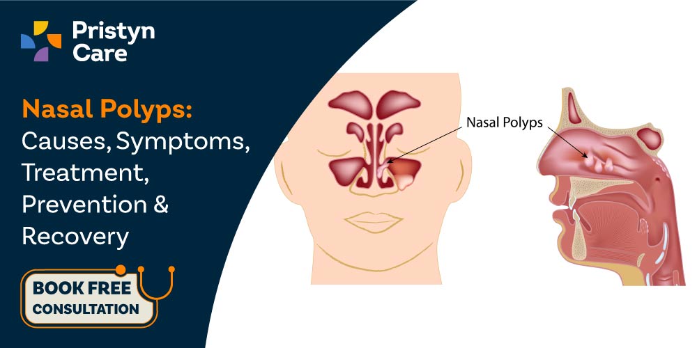 What Is Postnasal Drip Causes Symptoms Treatment