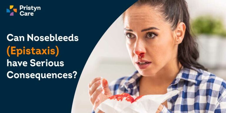 Can Nosebleeds Be Serious? _ What is Nosebleed ? Can It Have Serious ...