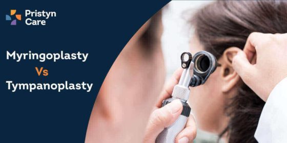 Myringoplasty vs Tympanoplasty - Pristyn Care
