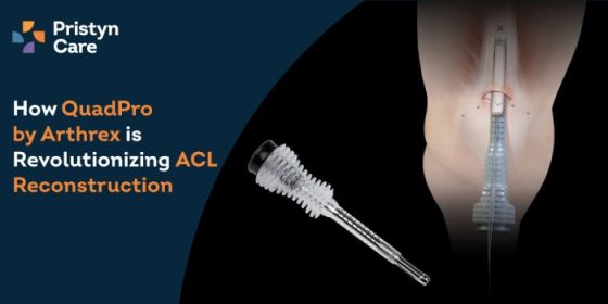 How QuadPro by Arthrex is Revolutionizing ACL Reconstruction - Pristyn Care