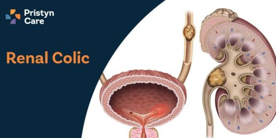 Renal Colic: Causes, Symptoms & Effective Treatment Options - Pristyn Care