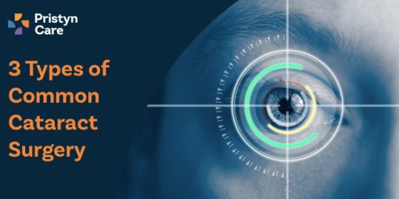 3 Types of Common Cataract Surgery: Choose the Right One - Pristyn Care
