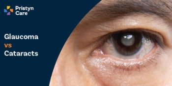 Glaucoma Vs Cataracts - Pristyn Care