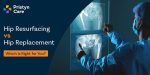 Hip Resurfacing Vs. Hip Replacement: Which Is Right For You? - Pristyn Care