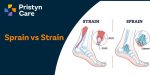 Sprain Vs Strain - Pristyn Care