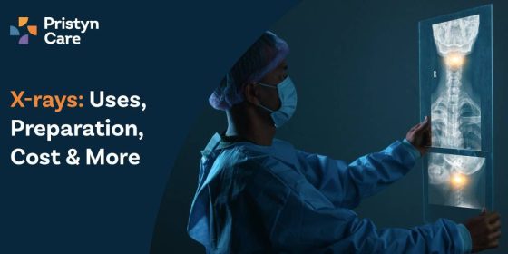 X-rays: Uses, Preparation, Cost & More - Pristyn Care