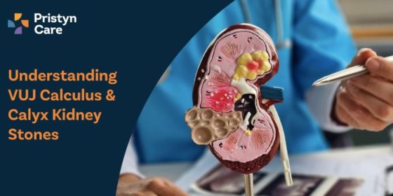 Understanding VUJ Calculus & Calyx Kidney Stones - Pristyn Care