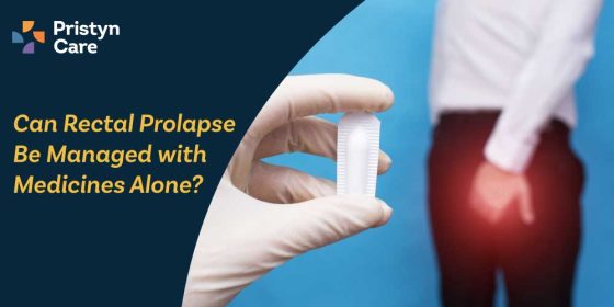 Can Rectal Prolapse Be Managed with Medicines Alone? - Pristyn Care