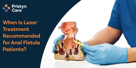 When Is Laser Treatment Recommended for Anal Fistula Patients ...