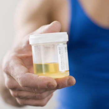 Hydrocele - Causes, Symptoms, Diagnosis, Treatment, Recovery