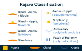 Everything You Should Know about Axillary Breast Tissue