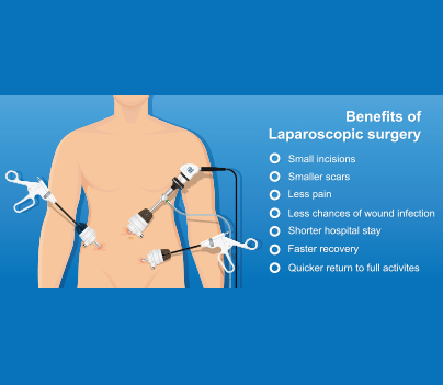 Advanced Appendix Laser Operation